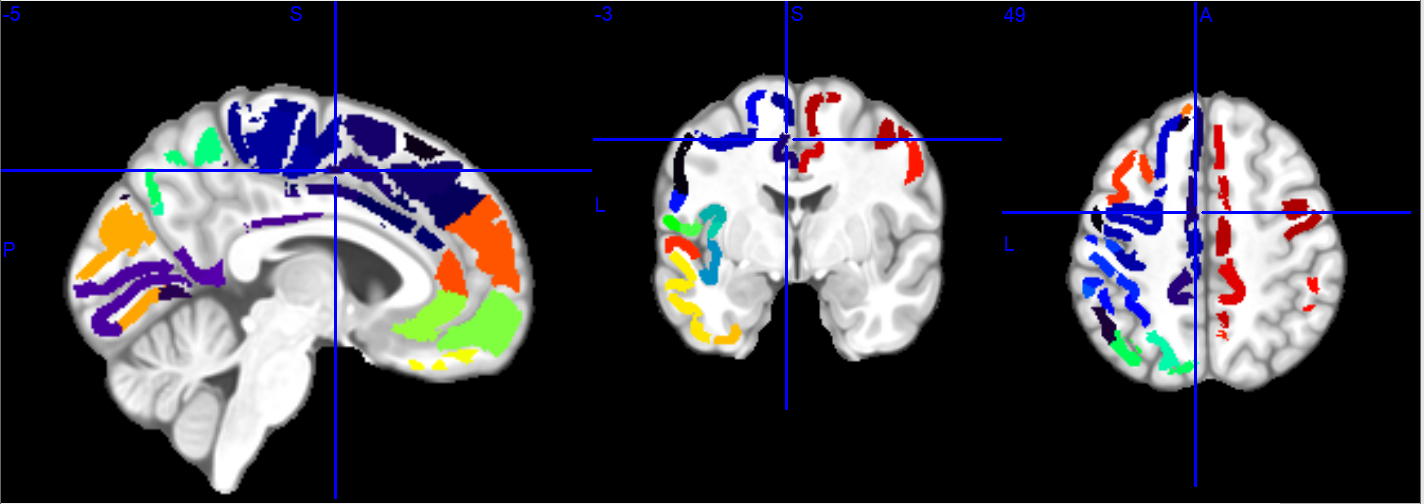 Brain atlases not registering correctly to the MNI brain or T1w brain ...