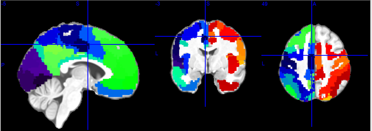 Brain atlases not registering correctly to the MNI brain or T1w brain ...