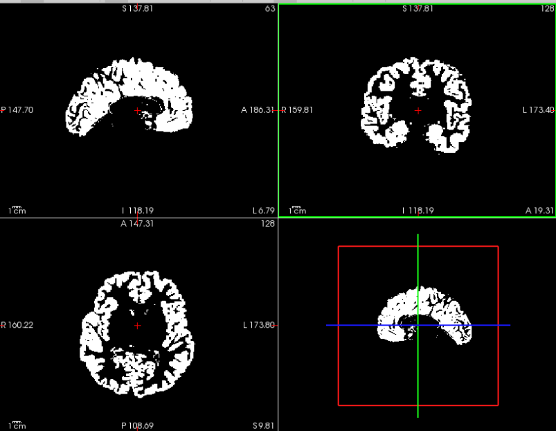 Issue with brain segmentation image after using ImageMath · Issue #1510 · ANTsX/ANTs · GitHub