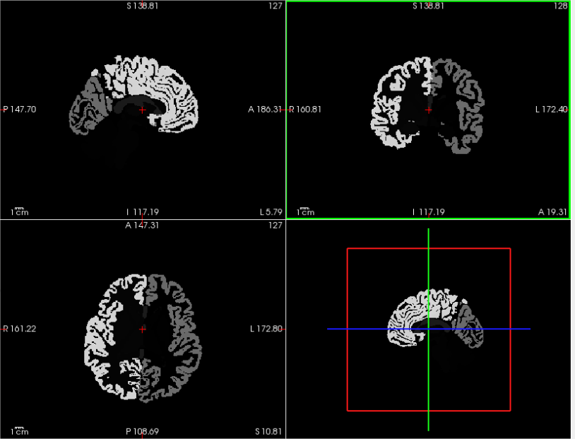 Issue With Brain Segmentation Image After Using Imagemath · Issue 1510 · Antsx Ants · Github