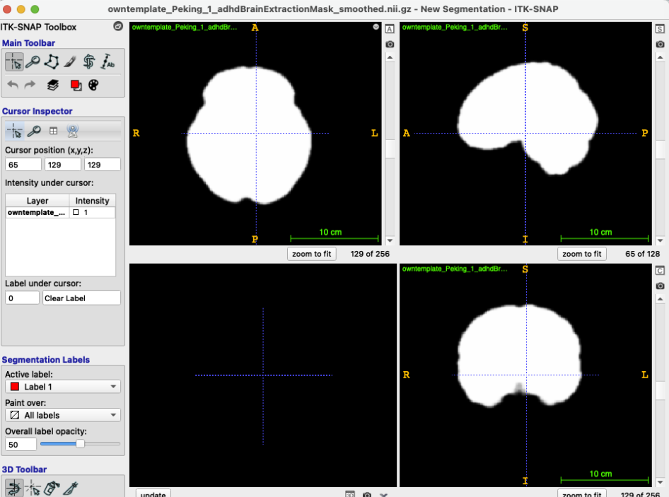 ANTsCorticalThickness.sh gives error in Step 6 · Issue #1528 · ANTsX/ANTs · GitHub