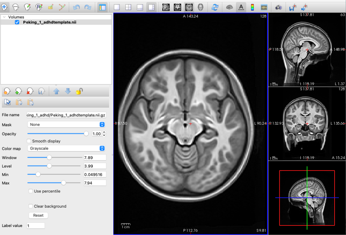ANTsCorticalThickness.sh gives error in Step 6 · Issue #1528 · ANTsX/ANTs · GitHub