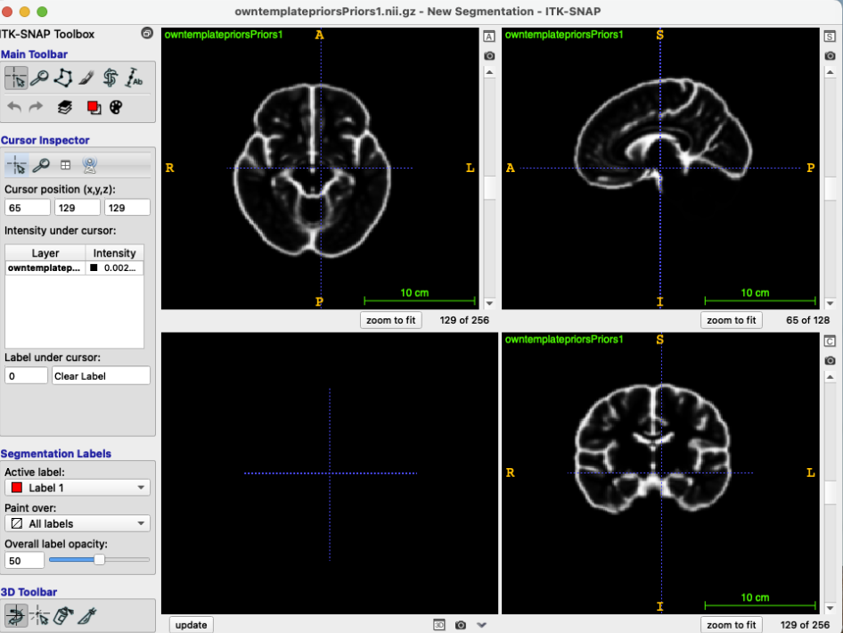 ANTsCorticalThickness.sh gives error in Step 6 · Issue #1528 · ANTsX/ANTs · GitHub