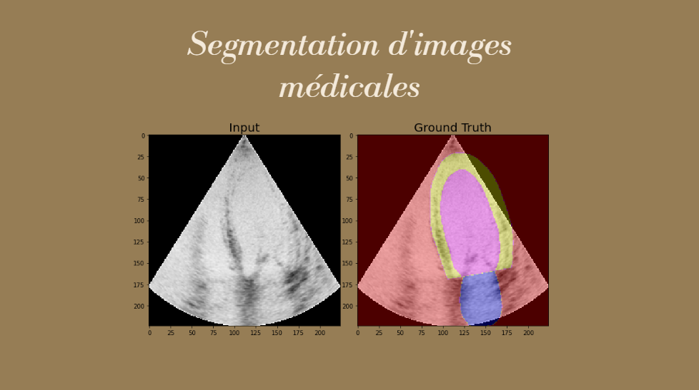 GitHub - tef76/Unet-vs-PVT-on-medical-image-segmentation: L'objectif de mon TER lors de mon ...
