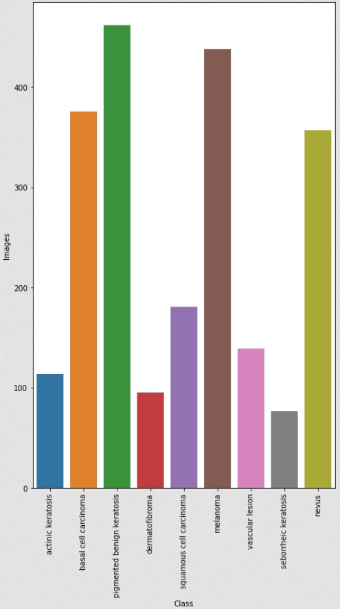 GitHub - elcommselva/Melanoma_Detection_CNN