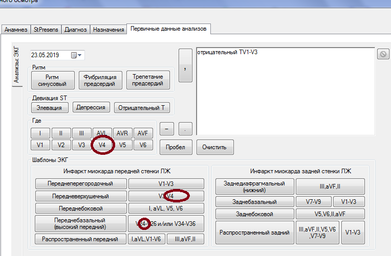 ЭКГ, V4 · Issue #478 · rdn1983/cardiology · GitHub