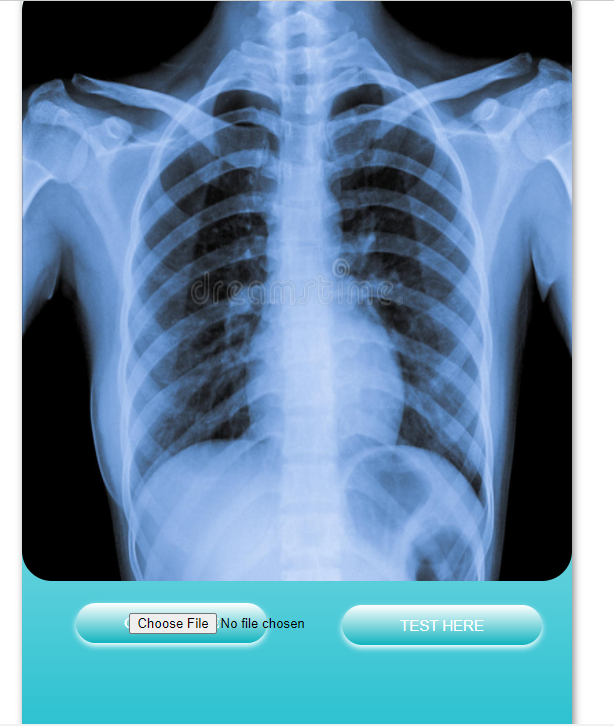 GitHub - ronyjoseph007/covid19_detection_using_chest_XRAYS