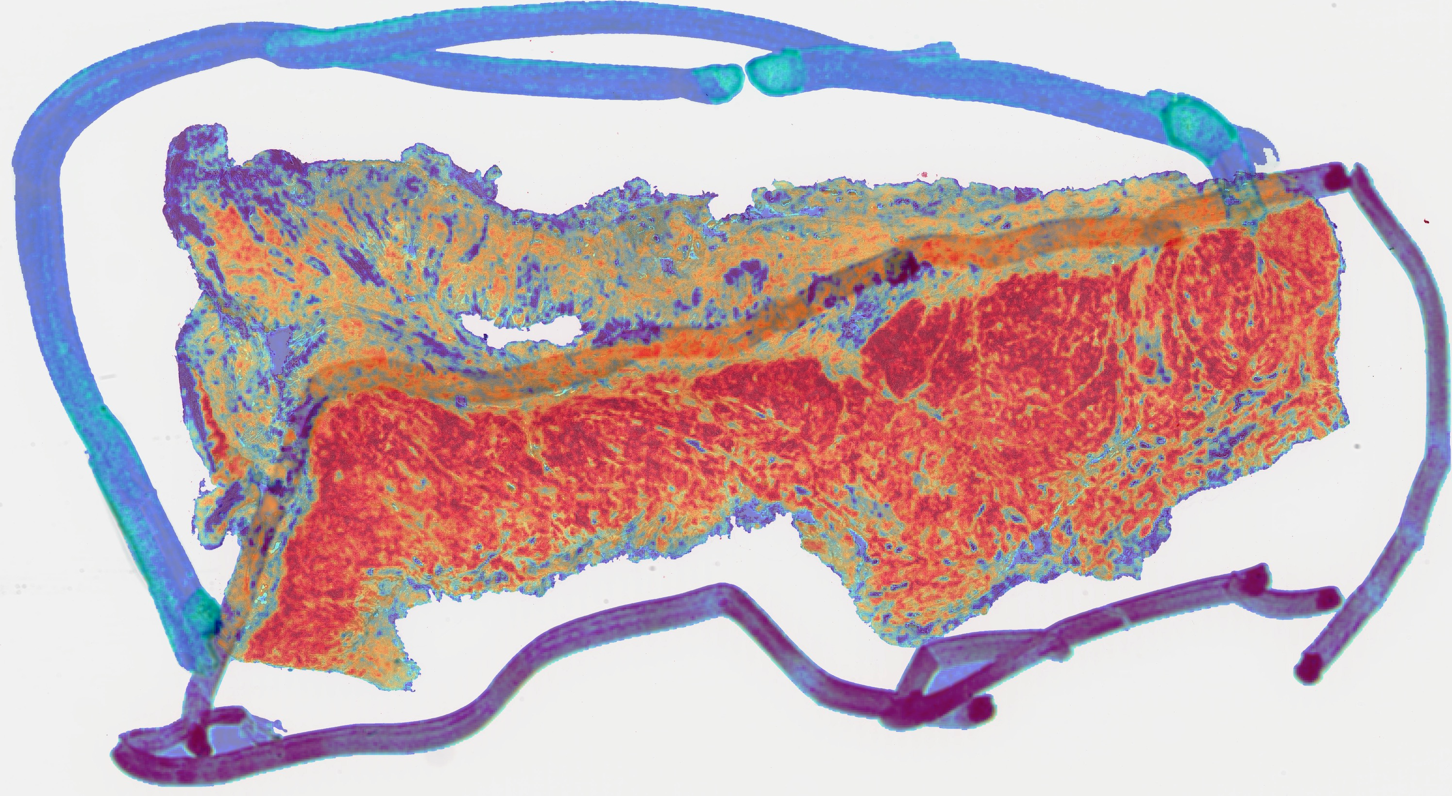 Problem of getting threshold of high/low attention score and create patches problem · Issue #95 ...