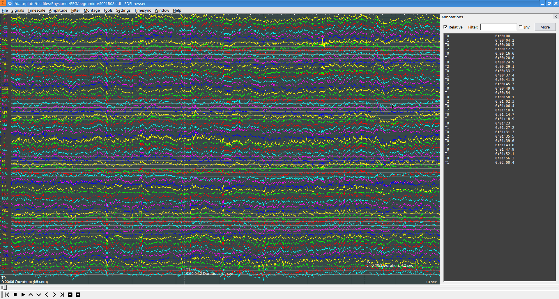 Issue loading EDF/EDF+ files · Issue #255 · sccn/eeglab · GitHub