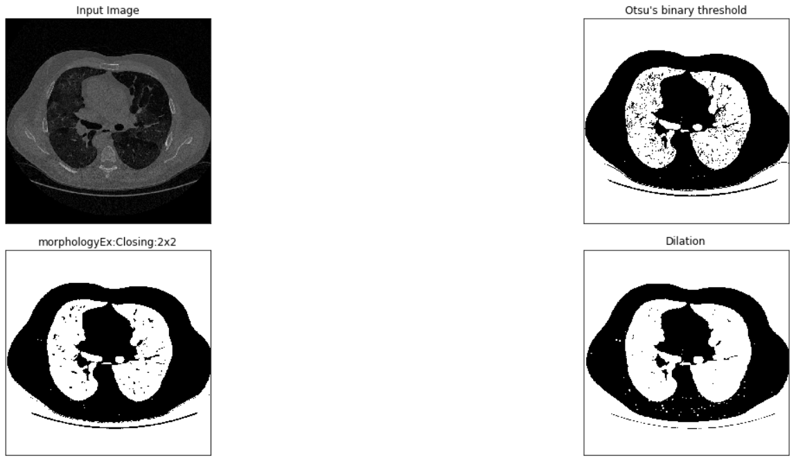 GitHub - KrishnaVeer7712/Lung-CT-Image-Segmentation-and-COVID-19 ...