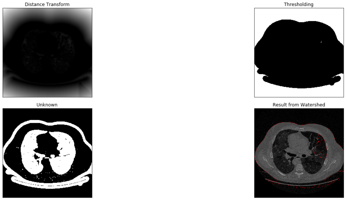 GitHub - KrishnaVeer7712/Lung-CT-Image-Segmentation-and-COVID-19-Infection-Detection: The aim of ...