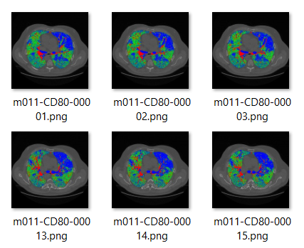 GitHub - KrishnaVeer7712/Lung-CT-Image-Segmentation-and-COVID-19 ...