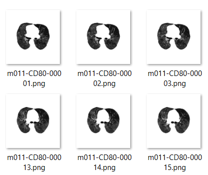 GitHub - KrishnaVeer7712/Lung-CT-Image-Segmentation-and-COVID-19 ...