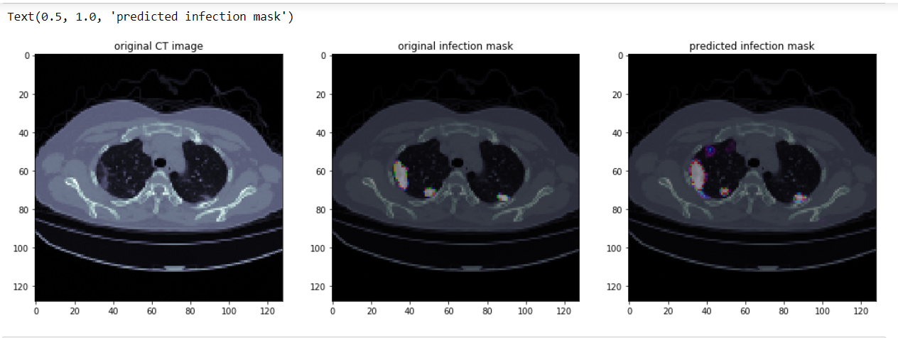 GitHub - KrishnaVeer7712/Lung-CT-Image-Segmentation-and-COVID-19 ...
