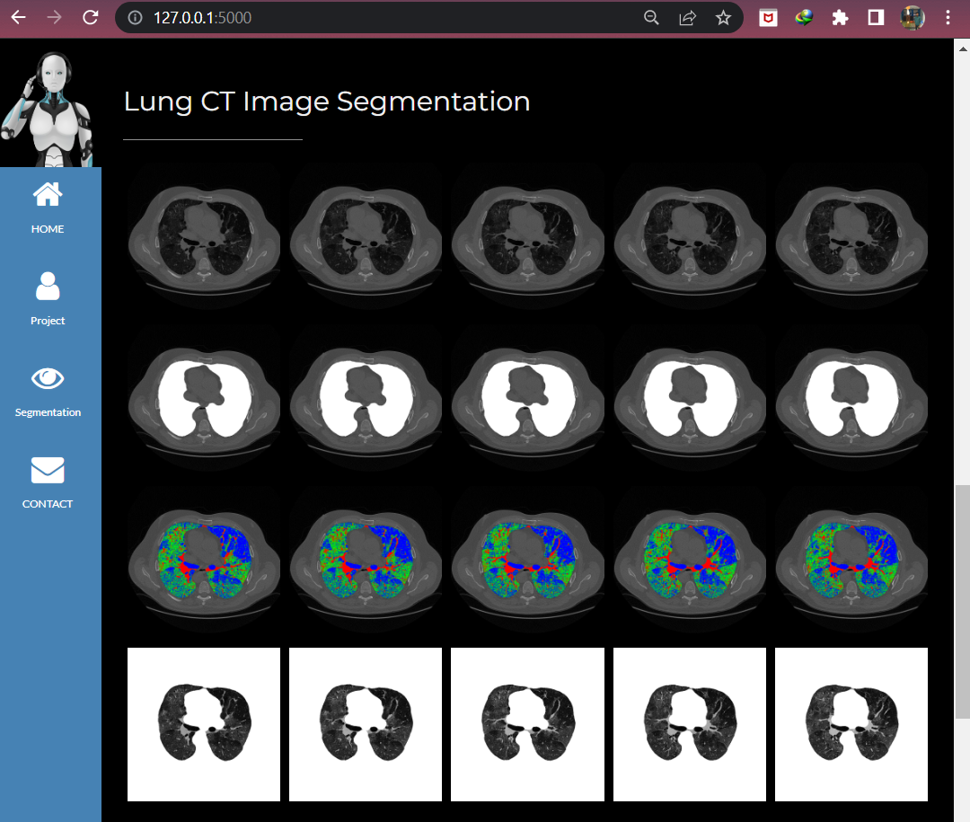 GitHub - KrishnaVeer7712/Computed-Tomographic-Images-Segmentation-and ...