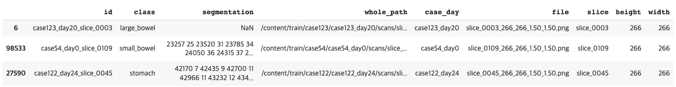 GitHub - jayicebear/cancer-segmantation