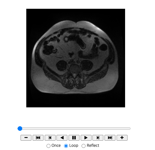 GitHub - jayicebear/cancer-segmantation