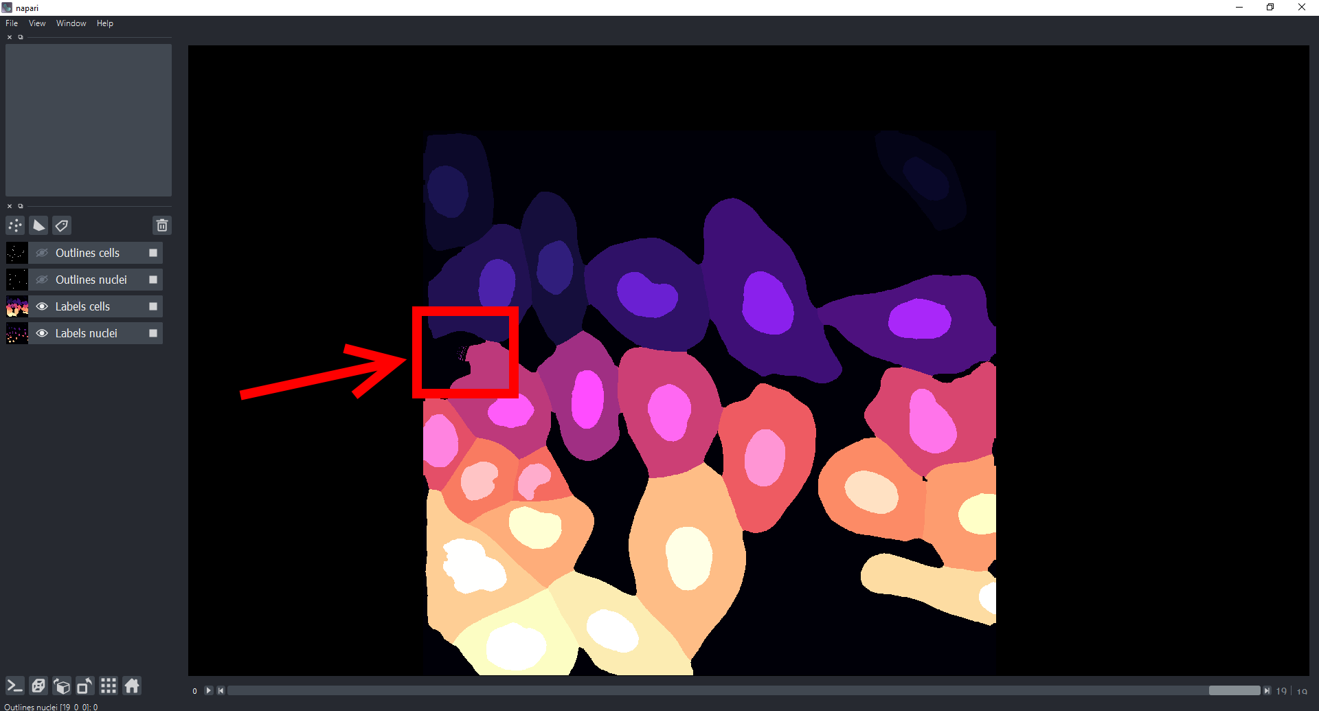 Segmentation artifacts using cytoplasm model · Issue #35 · MouseLand/cellpose · GitHub