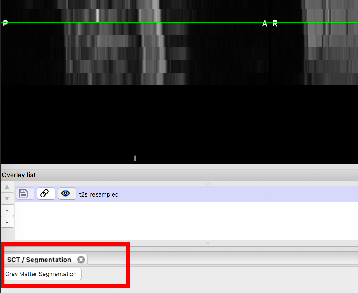 Suggestion for the future: SCT integration into FSL · Issue #1623 · spinalcordtoolbox ...