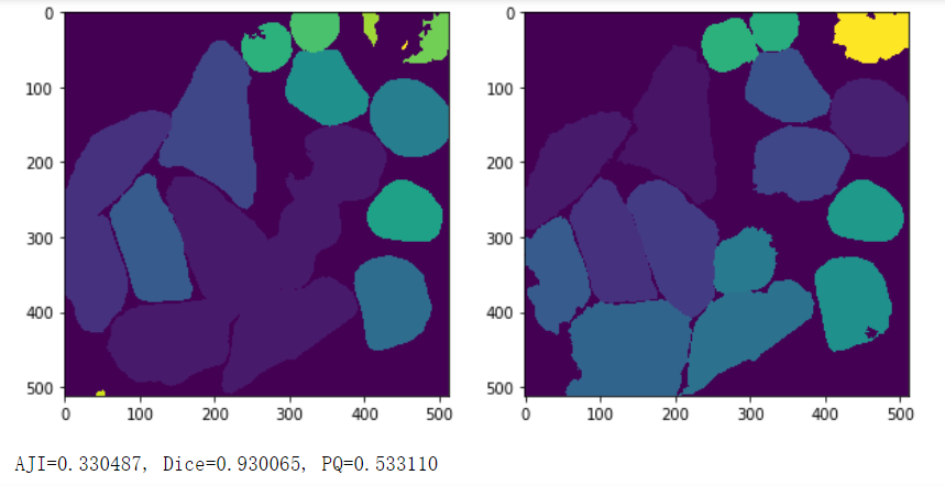 How to set training parameters on my own datasets - Cell Tracking Dataset · Issue #73 · vqdang ...