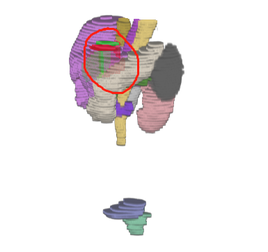 Save the problem. Not all views are saved after sketching · Issue #460 · niivue/niivue · GitHub