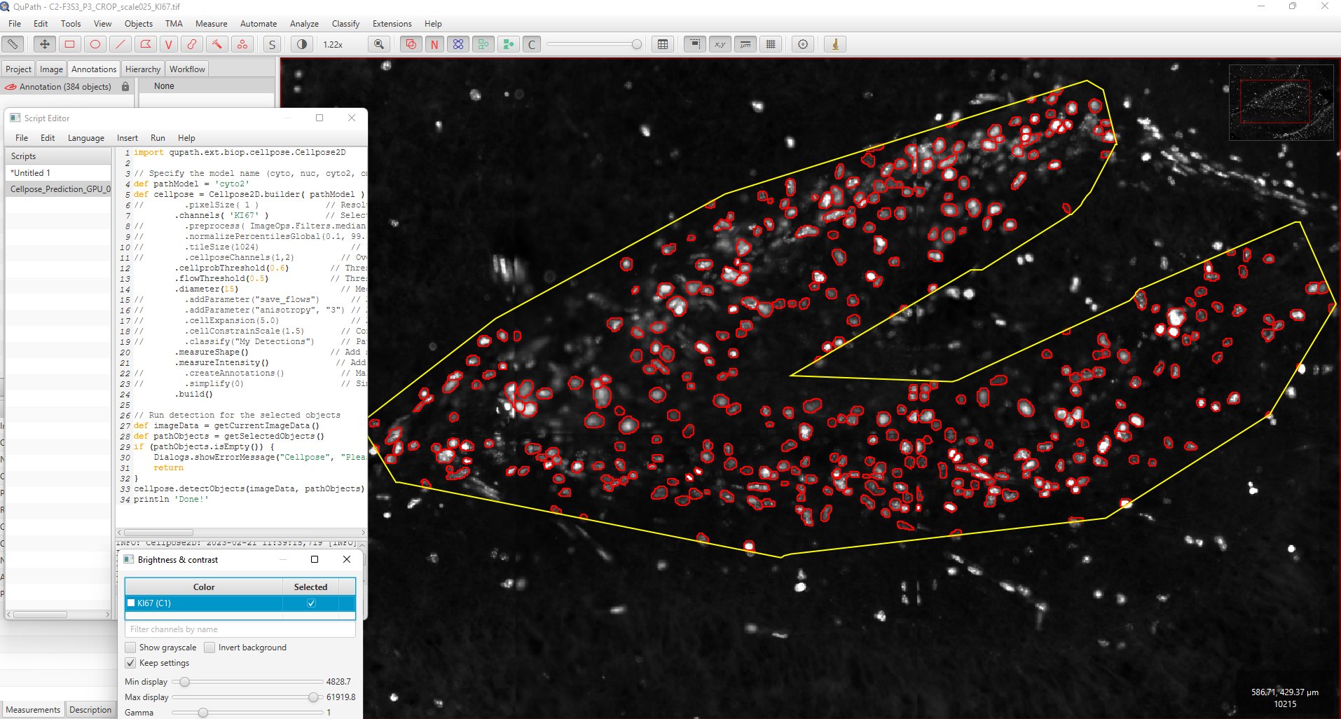 GitHub - Imagimm-CIML/convert-mrxs-to-ometiff
