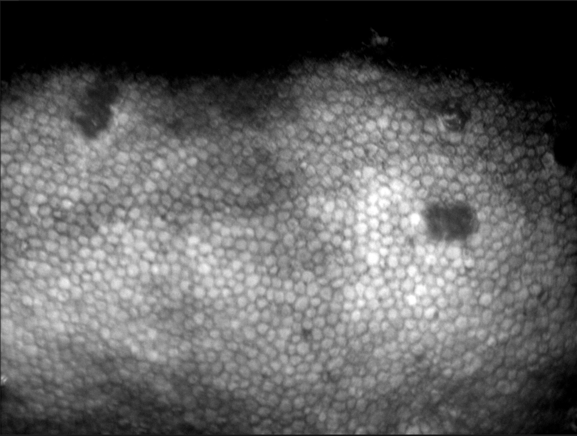 Inference from ViTAutoEnc during SSL · Project-MONAI tutorials ...