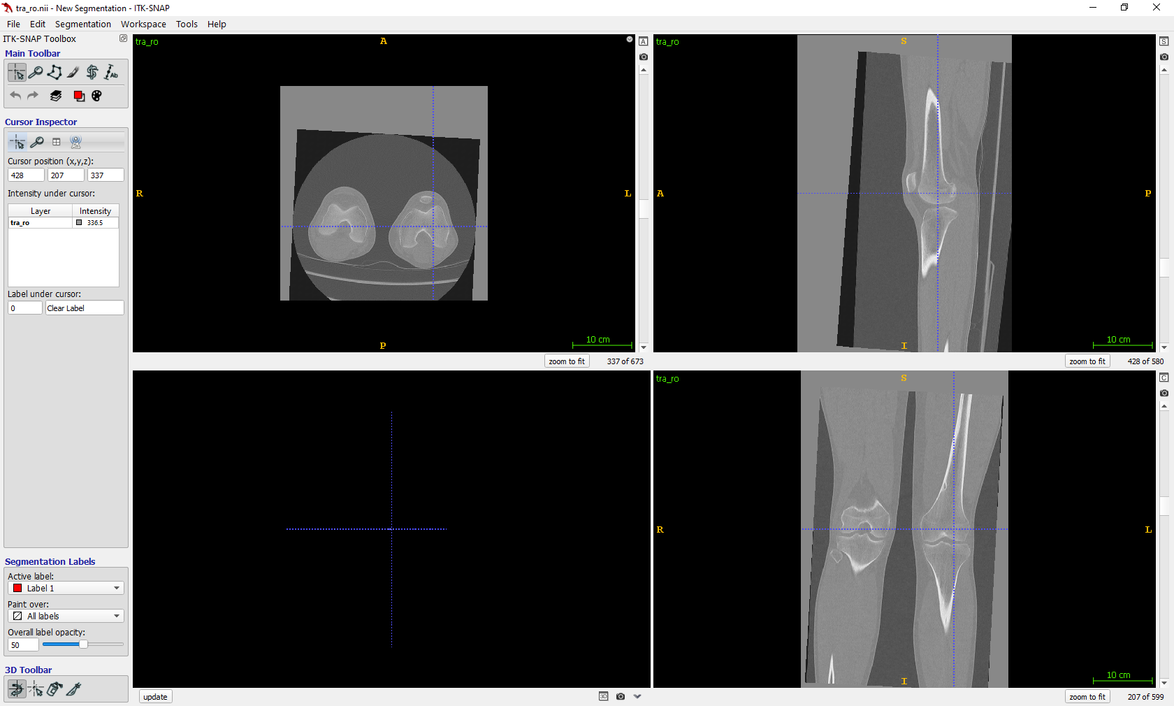 How to resample sitk_image to a new spacing? · Issue #561 · SimpleITK/SimpleITK · GitHub