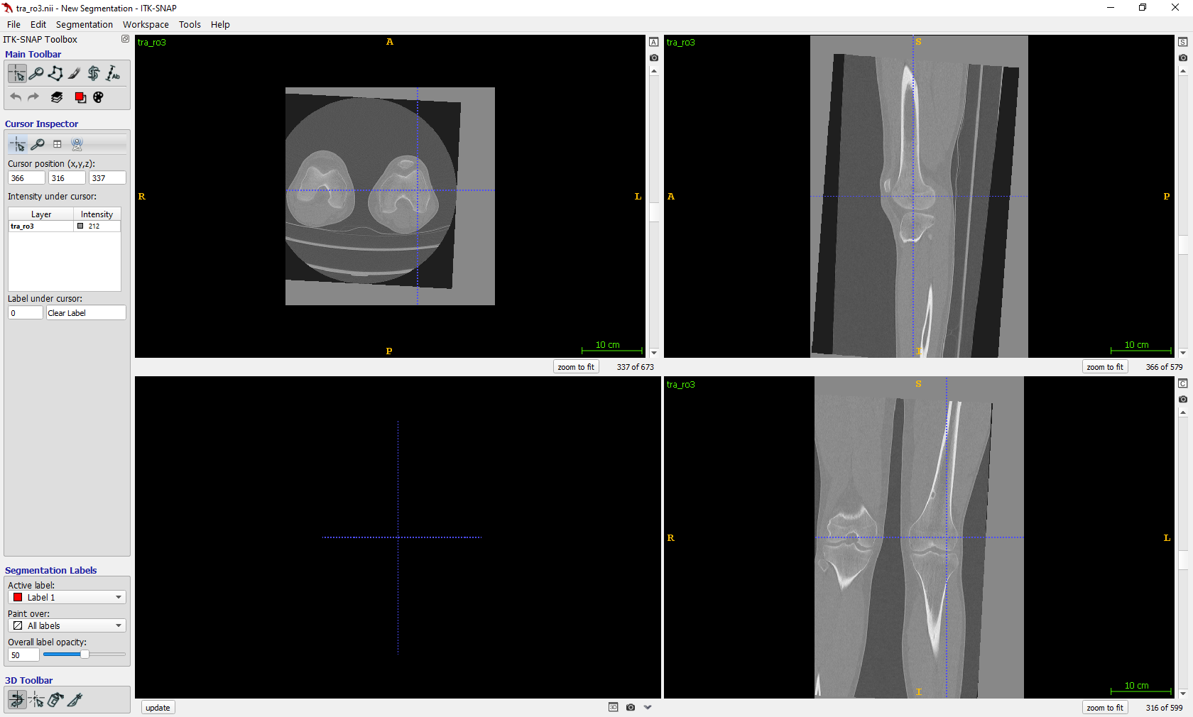 Question: How do i properly define resamping grid for rotation & translation of 3D image volume ...