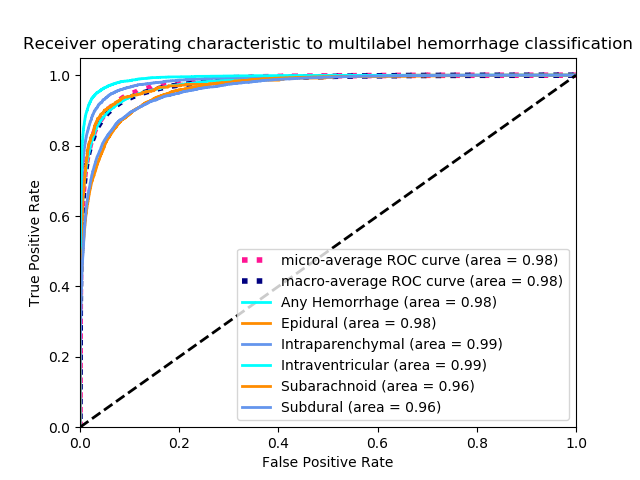 GitHub - juansecas/RSNA_ICH_DL: A deep learning framework for automatic detection of ...
