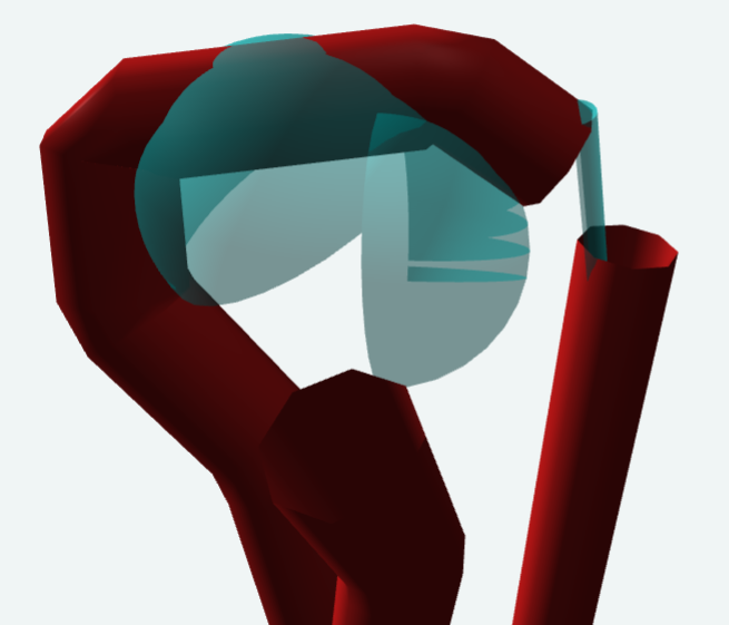 Rendering artifacts in wrap geometry · Issue #352 · opensim-org/opensim ...