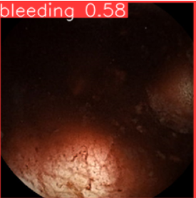 GitHub - mananchawla2005/WCEBleedGenAI: Repository for WCEBleedGen challenge to classify ...