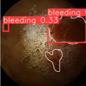 GitHub - mananchawla2005/WCEBleedGenAI: Repository for WCEBleedGen challenge to classify ...