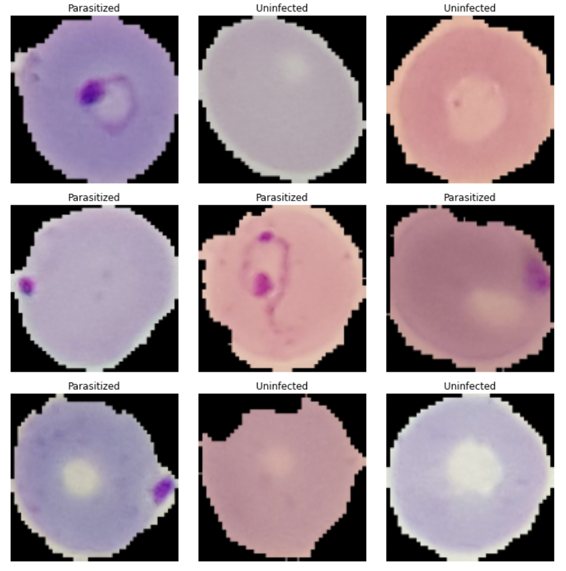 GitHub - vrxshxnk/malaria-detection: Classifying images of the dataset ...