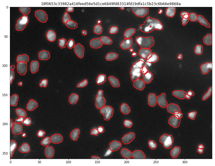 Added And Manualy Fixed Remaining Files By Pdima · Pull Request 8 · Lopuhin Kaggle Dsbowl 2018