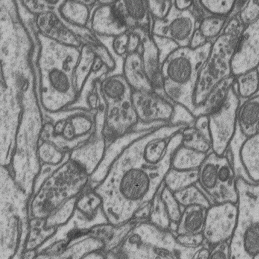 GitHub - computational-cell-analytics/micro-sam: Segment Anything for Microscopy