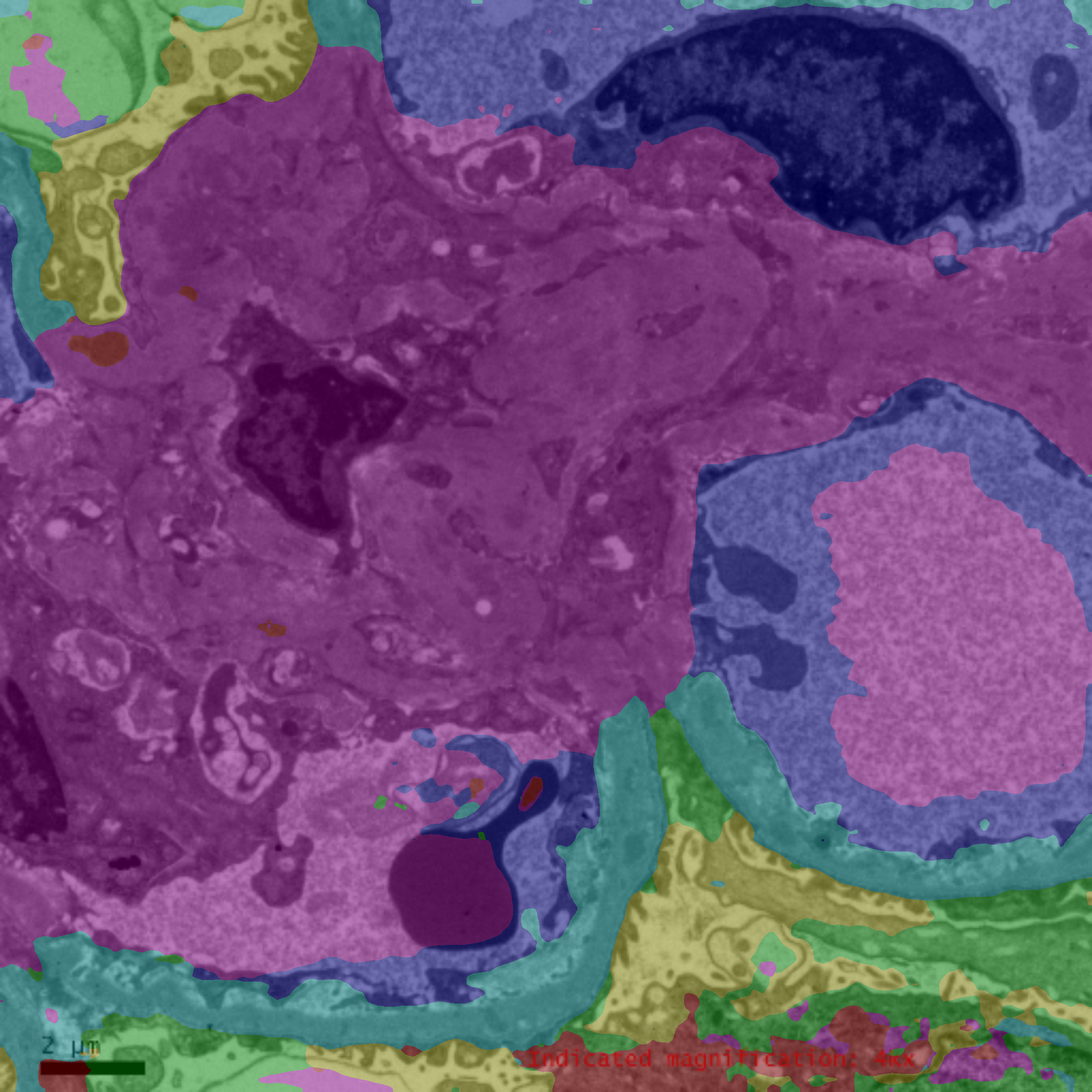 the png from test.py has no background color · Issue #2346 · open-mmlab ...