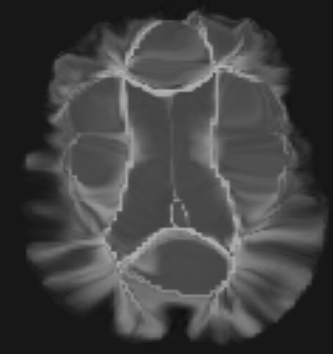 Registration with own data · Issue #151 · voxelmorph/voxelmorph · GitHub