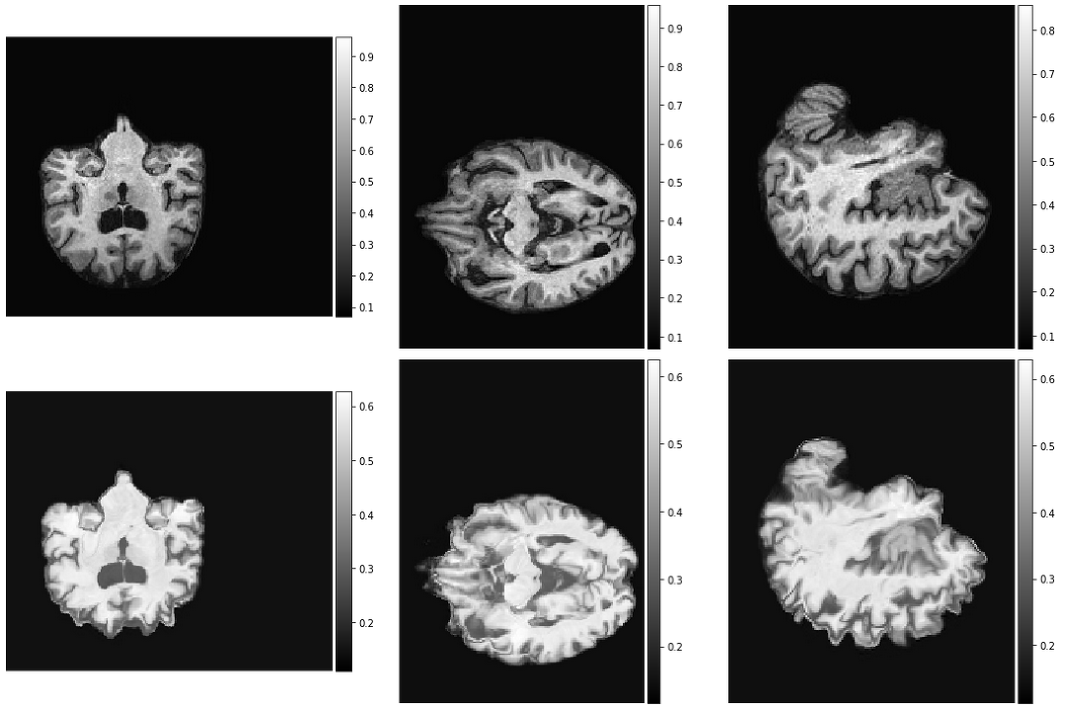 Registration with own data · Issue #151 · voxelmorph/voxelmorph · GitHub