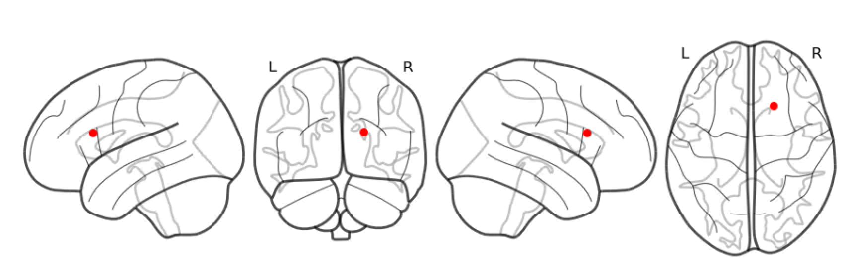 plot_glass_brain add_markers make not transparent between the ...