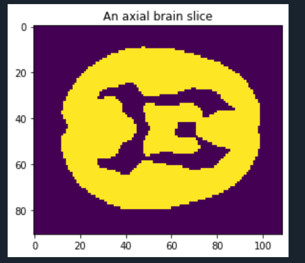 Grey matter mask MNI too big? · Issue #468 · brainiak/brainiak · GitHub
