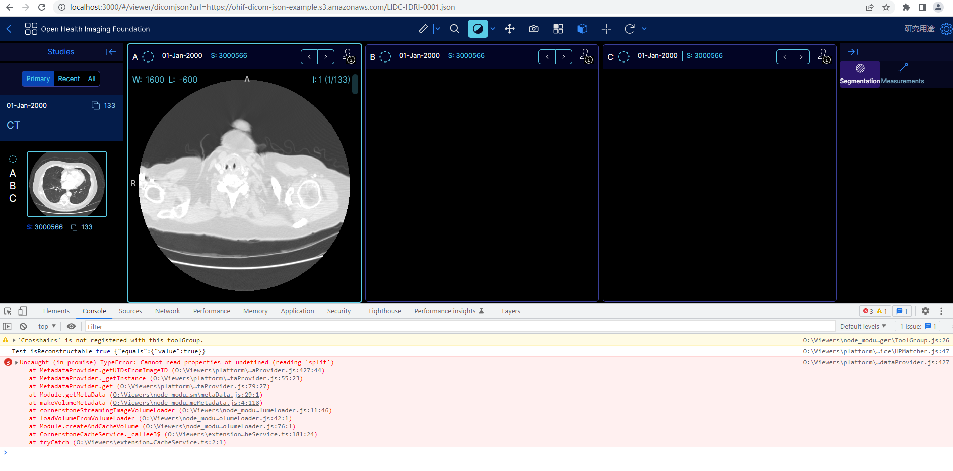 MPR doesn't work when I use JSON schema · Issue #3084 · OHIF/Viewers · GitHub