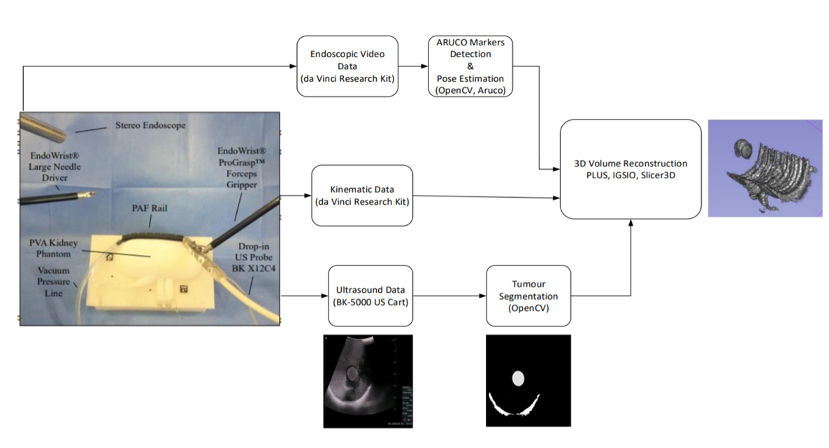 GitHub - HarrisKomn/3D-US-Reconstruction-of-tumor-masses: 3D reconstruction of masses in the ...