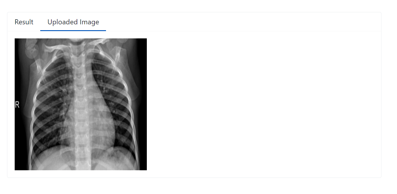 GitHub - Nakul74/Pneumonia-detection-with-CNN