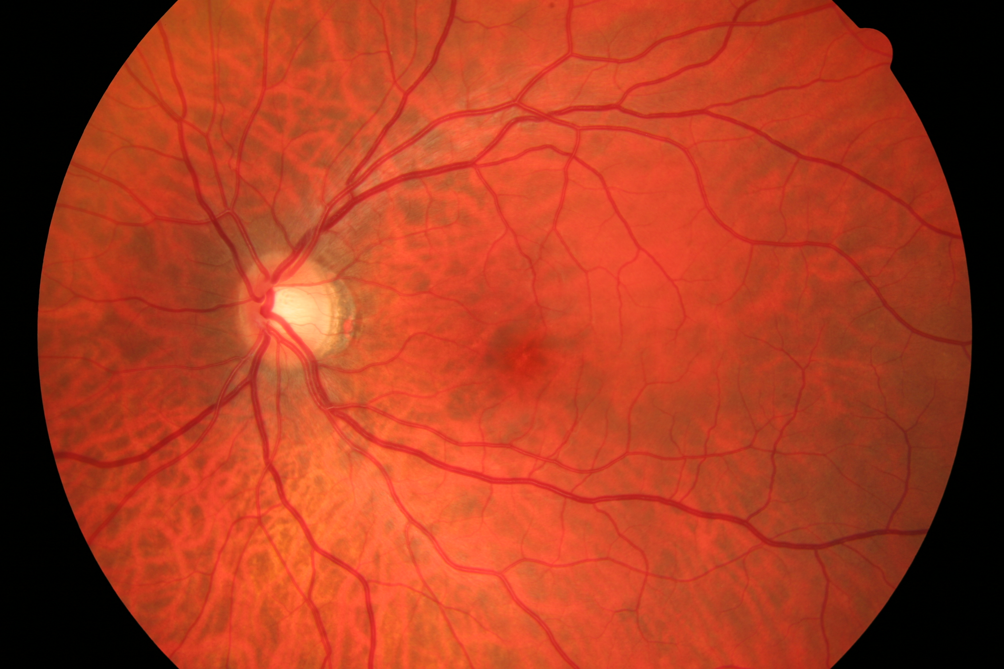 GitHub - Haifafh/MFAT: MATLAB implementation of '2D and 3D Vascular Structures Enhancement via ...