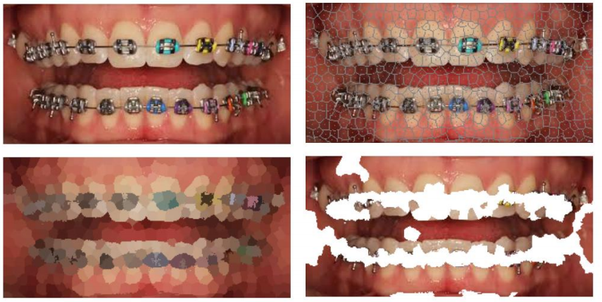 GitHub - vutuanhai237/AutoAligmentLeaf