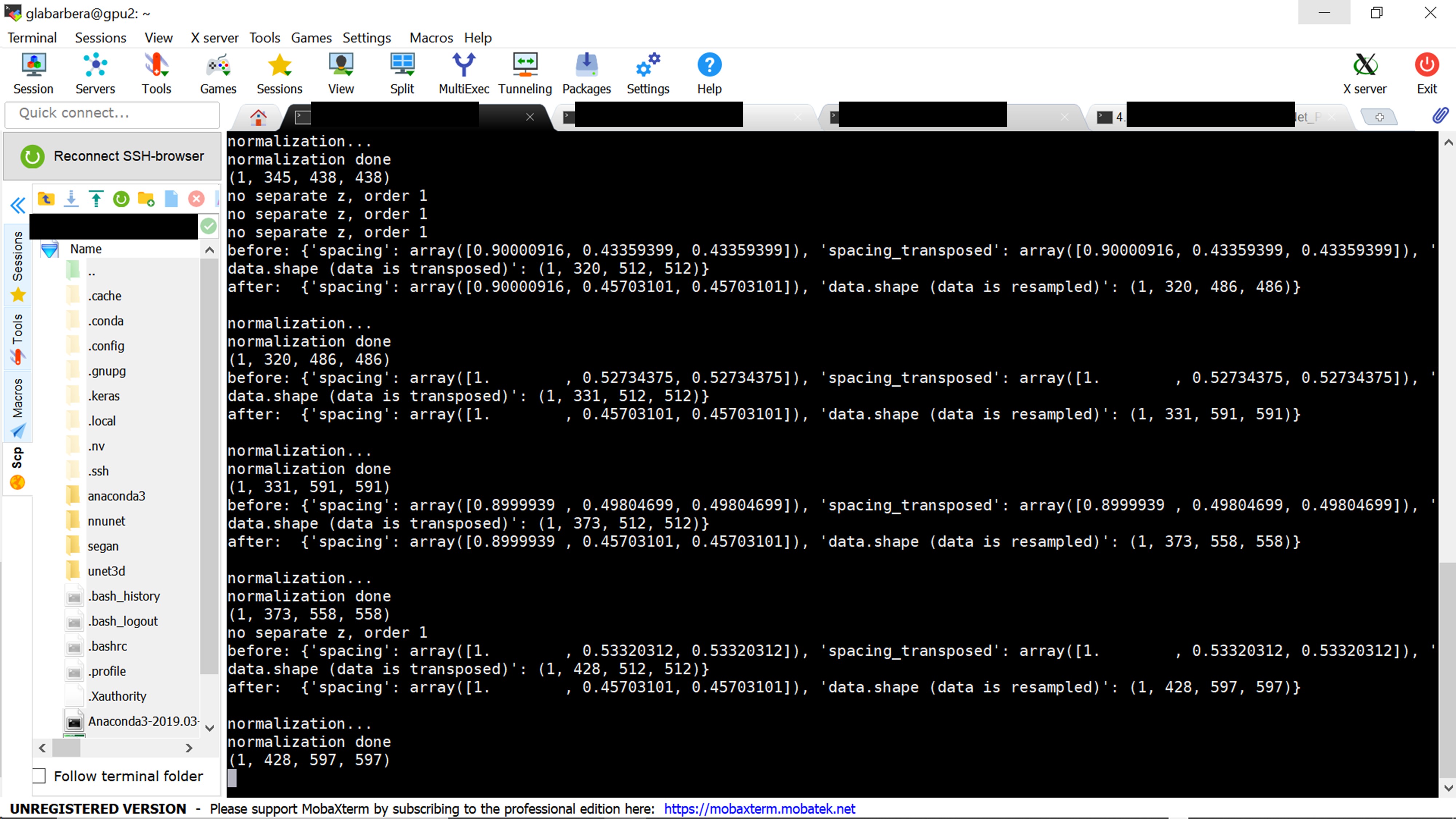 Problem with predict_simple.py for nnUNetTrainerV2_noDataAugmentation ...