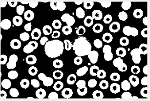 GitHub - Crackeree/Automatic-platelet-count-based-on-morphological-segmentation-technique-from ...