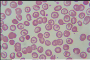 GitHub - Crackeree/Automatic-platelet-count-based-on-morphological-segmentation-technique-from ...