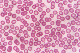 GitHub - Crackeree/Automatic-platelet-count-based-on-morphological-segmentation-technique-from ...